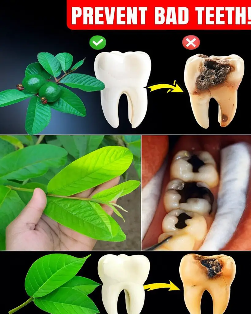 Top 3 Ways Guava Leaves Fight Tooth Decay – Easy recipes